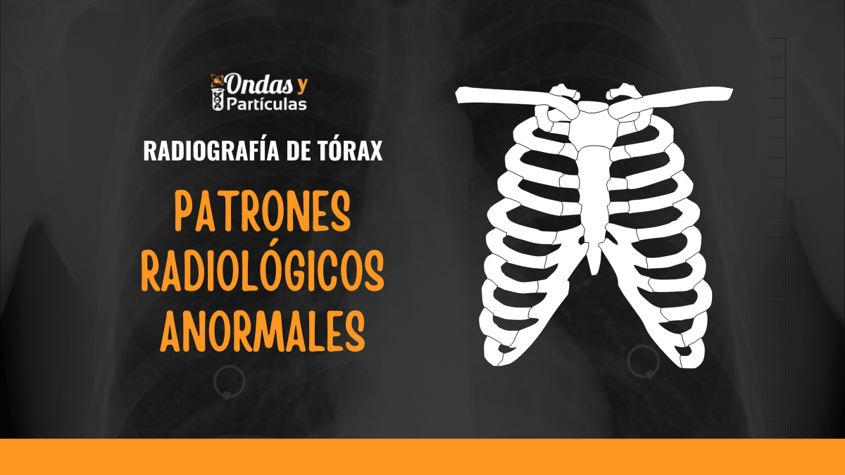¿Cómo interpretar una radiografía de tórax? Primera parte - Ondas y ...